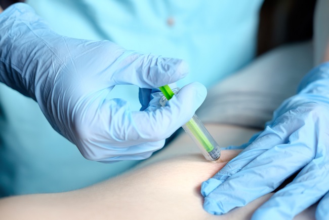 Basiliximab - Manfaat, dosis dan efek samping - Alodokter